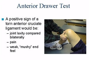 Medial Collateral Ligament Injury Test